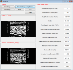 Research PhD Projects in Medical Image Processing (Doctoral Thesis)